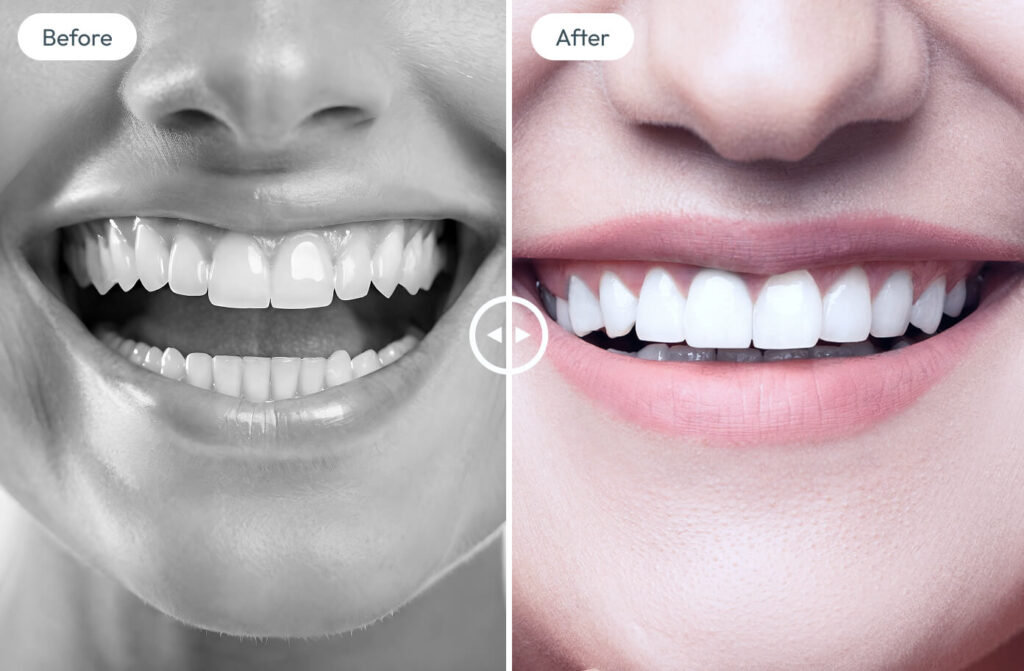 Hawaii Smile Designs – Orthodontist for Kids, Teens & Adults on the Big ...